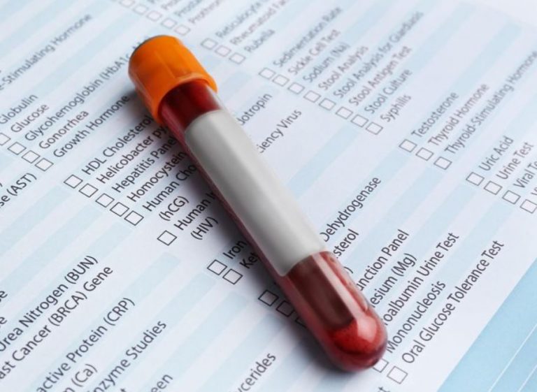 Lack of laboratory capacity at LUH may mean some blood samples will not ...